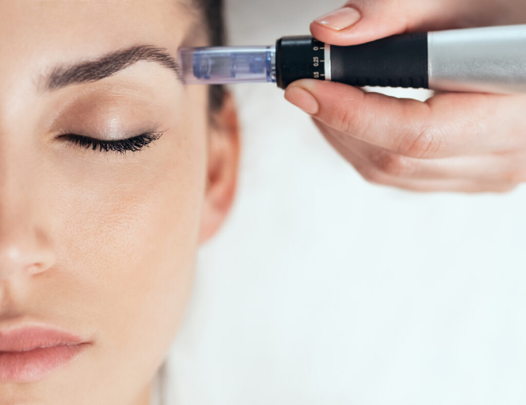 Pearl Bright DermaPen Facial | Radium Wellness Centre Singapore