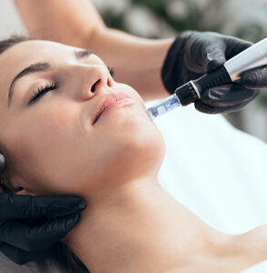 Pearl Bright DermaPen Facial | Radium Wellness Centre Singapore